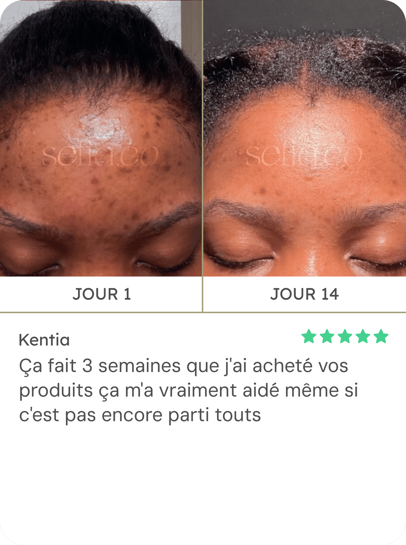 Sefia.co | Votre routine anti-taches brunes | Curcuma & Acide Kojique ...