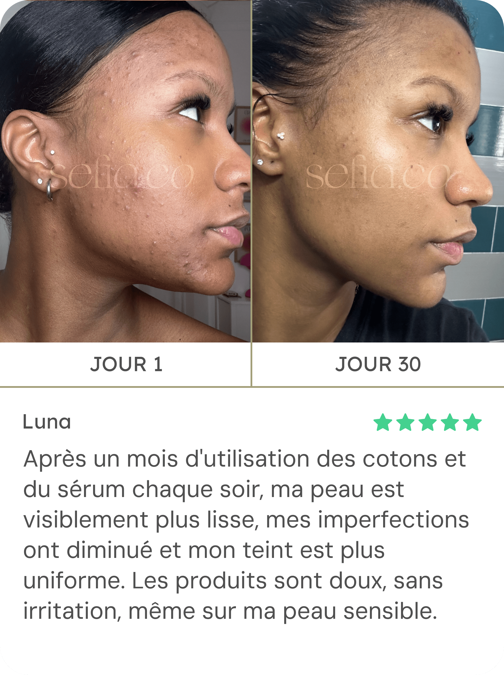 Sefia.co | Votre routine anti-taches brunes | Curcuma & Acide Kojique – Séfia