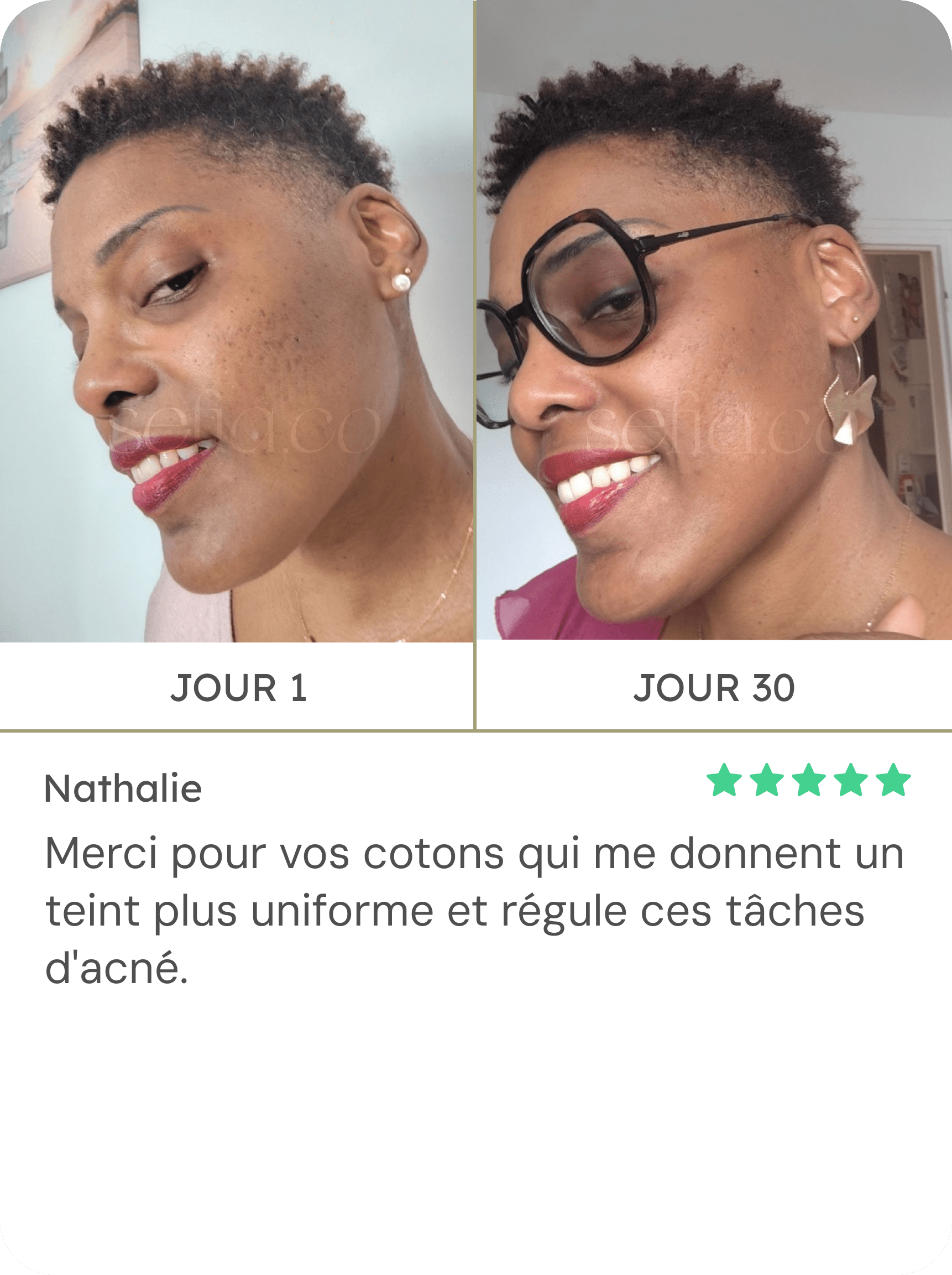 Sefia.co | Votre routine anti-taches brunes | Curcuma & Acide Kojique ...